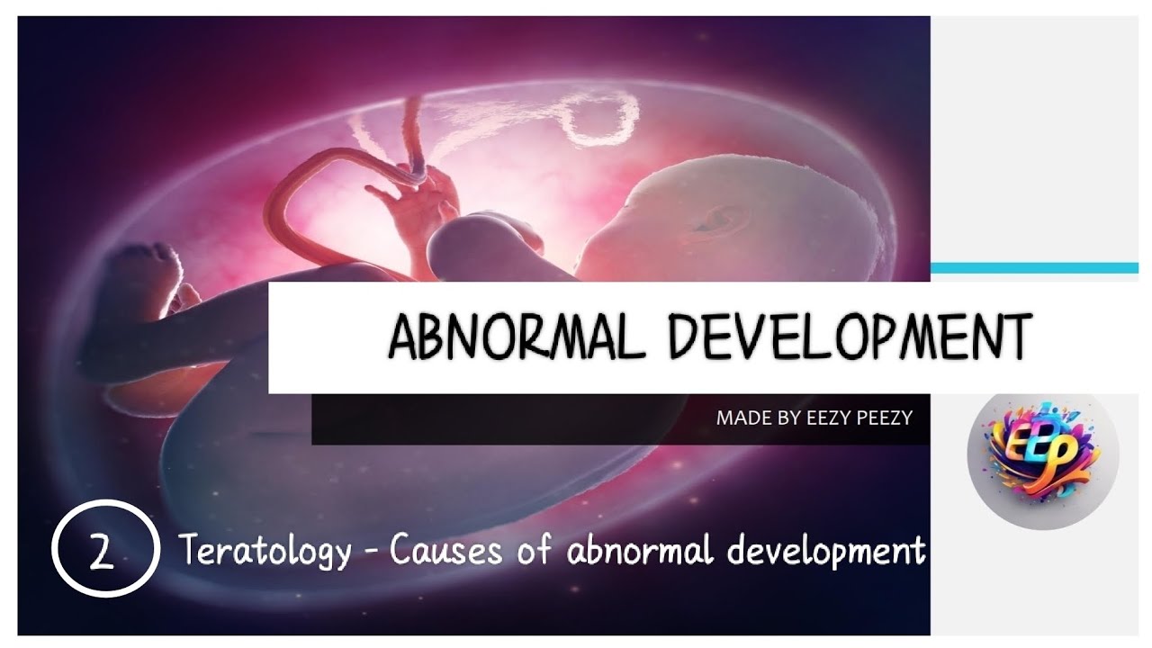 Teratology- causes of abnormal development ( developmental biology ...