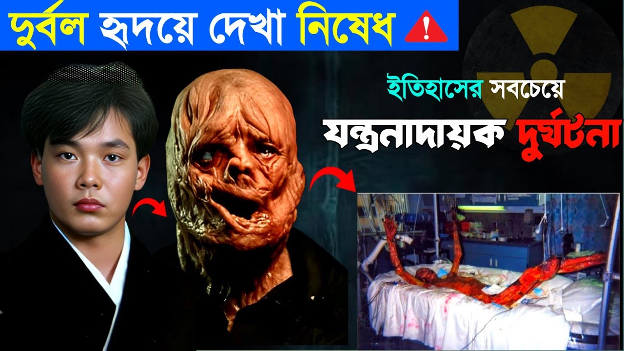 The Most RADIOACTIVE Man Ever☢️ || ৮৩ দিনের এক মর্মান্তিক সংঘর্ষ ...