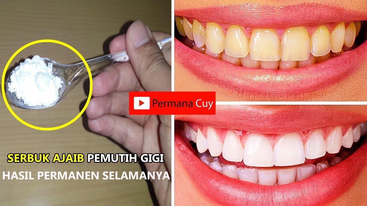 Tak Perlu Bleaching Gigi !! Dengan Cara Ini Dalam Hitungan Menit Gigi ...