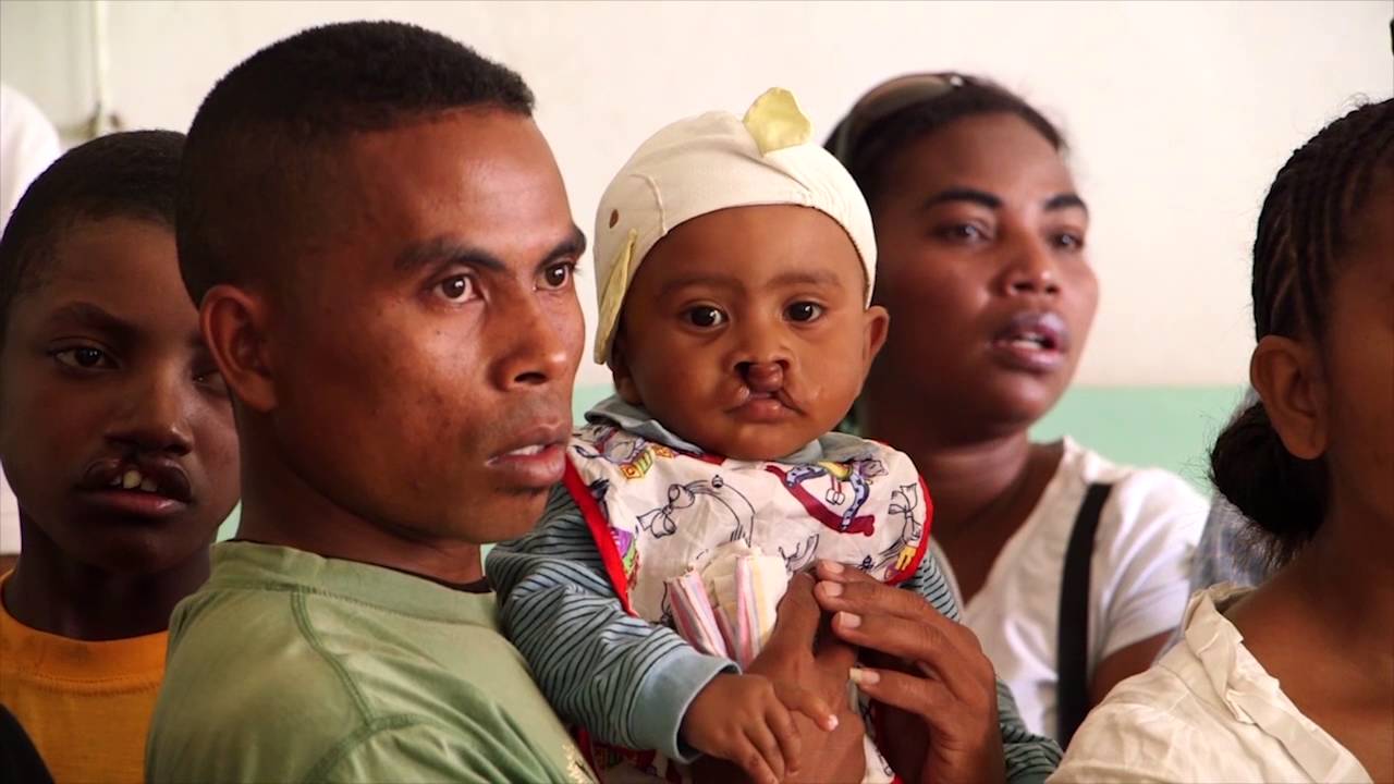 Operation Smile - YouTube