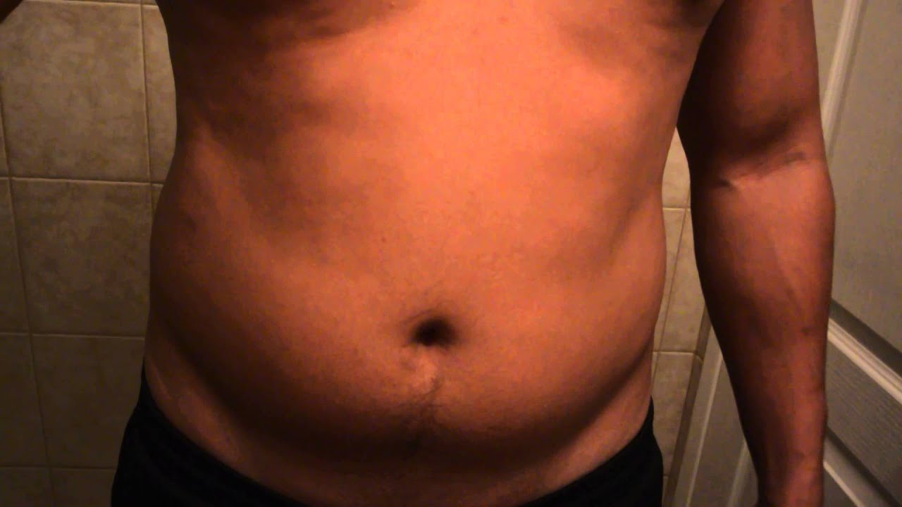 UD Skam - Day 17 - 180 degree angle of my stomach "Can I lose weight ...