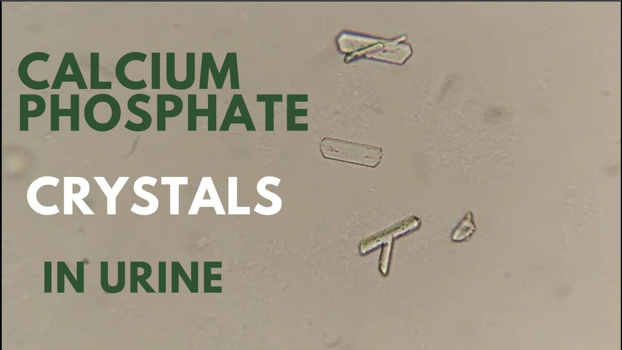 Calcium Phosphate Crystals