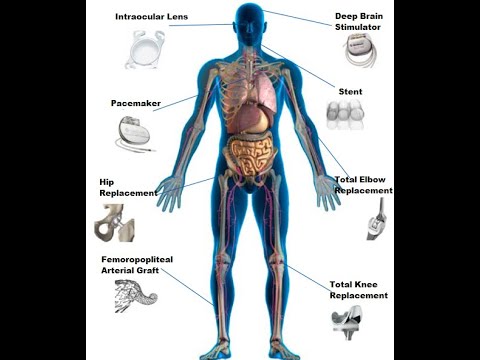 ICD-10-PCS Character 6 Devices - YouTube