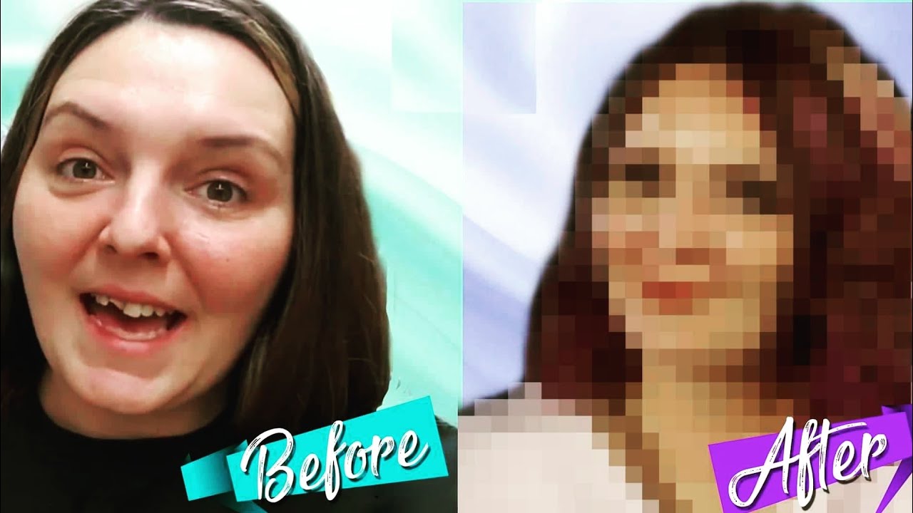$2,500 Face Transformation - YouTube