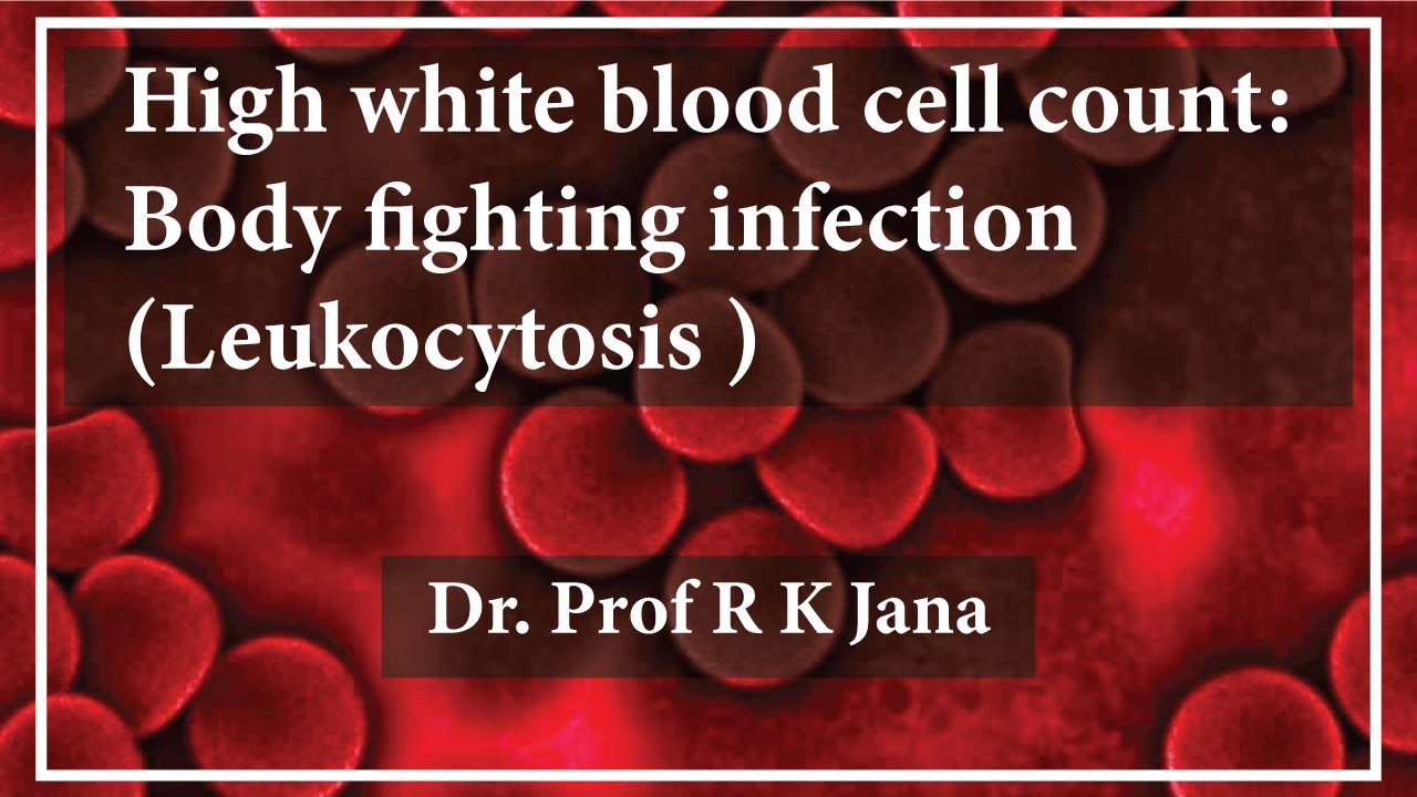 High white blood cell count : Body fighting infection ( Leukocytosis ...