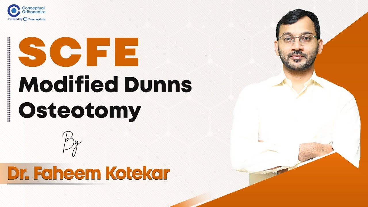 SCFE Modified Dunns Osteotomy by Dr.Faheem Kotekar ...