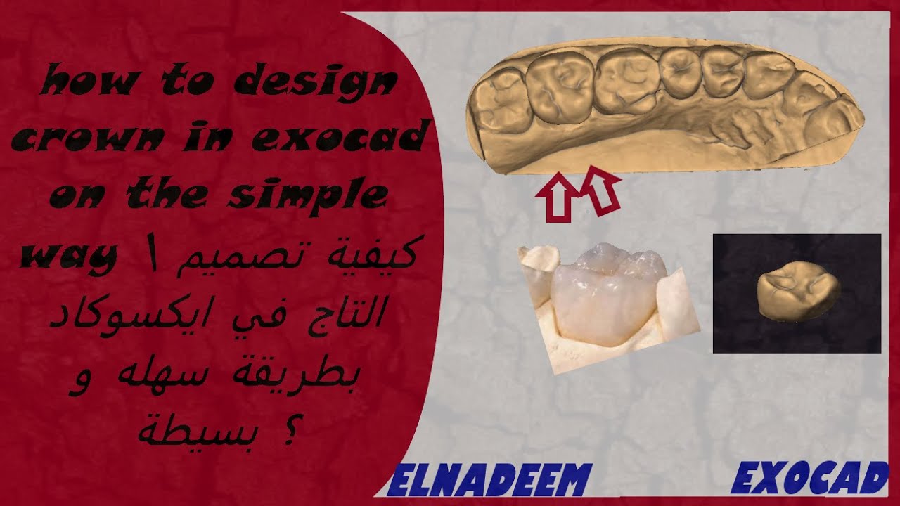 how to design crown in exocad on the simple way \كيفية تصميم التاج في ...