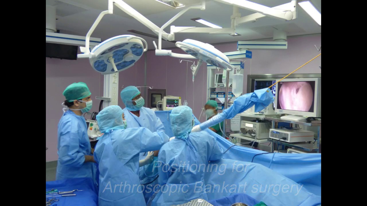 Arthroscopy of Shoulder - for recurrent dislocation. - Bankart with ...