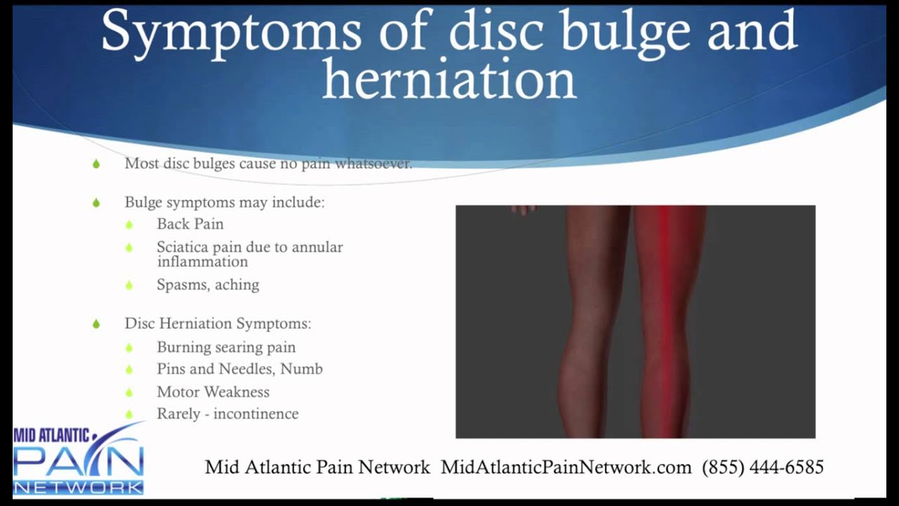 Disc Bulge and Herniation Explained by Mid Atlantic Pain Network - YouTube