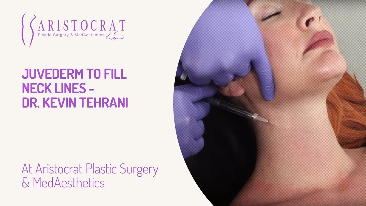 Juvederm to fill Neck Lines - Dr. Kevin Tehrani - YouTube