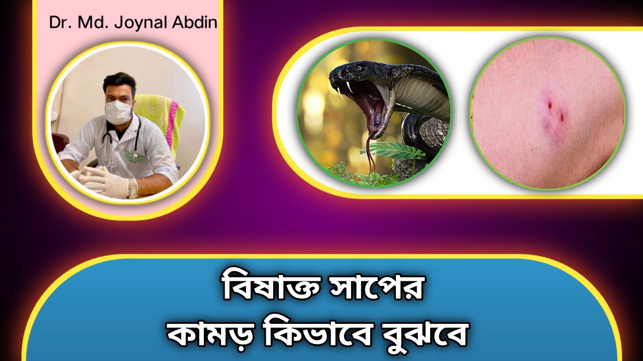 বিষাক্ত সাপ কামড় দিলে কি করবেন | Health Tips | Dr. Md. Joynal Abdin ...