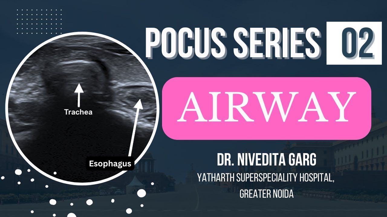 POCUS Airway: Revolutionizing Airway Management with Ultrasound I Dr ...