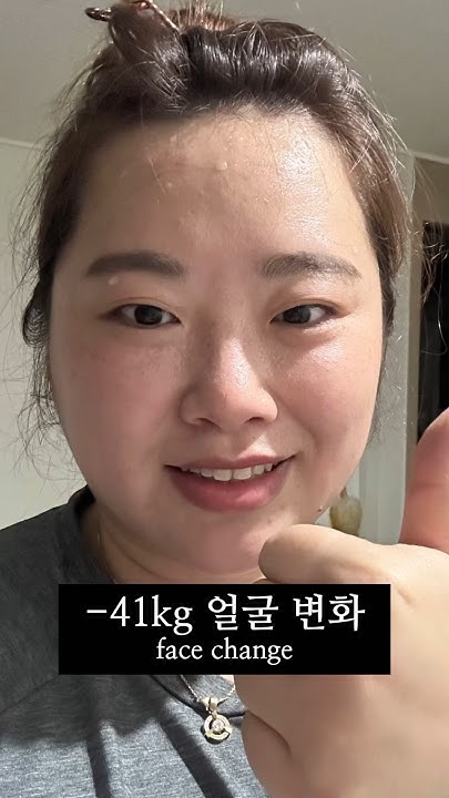 [115.7kg 👉🏻 74.7kg] -41kg 얼굴 변화 #다이어트전후 #diet #beforeandafter #shorts - YouTube