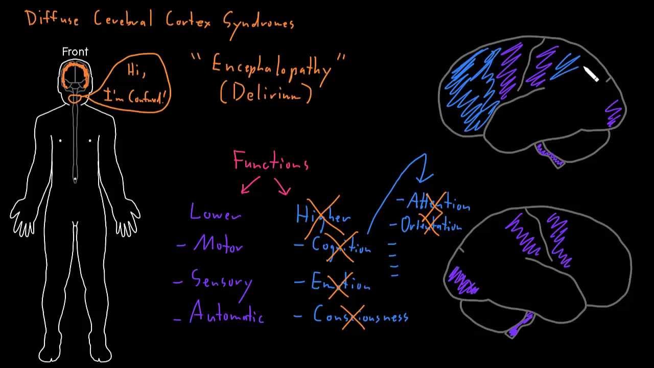Syndrome: Diffuse cerebral cortex syndromes - YouTube