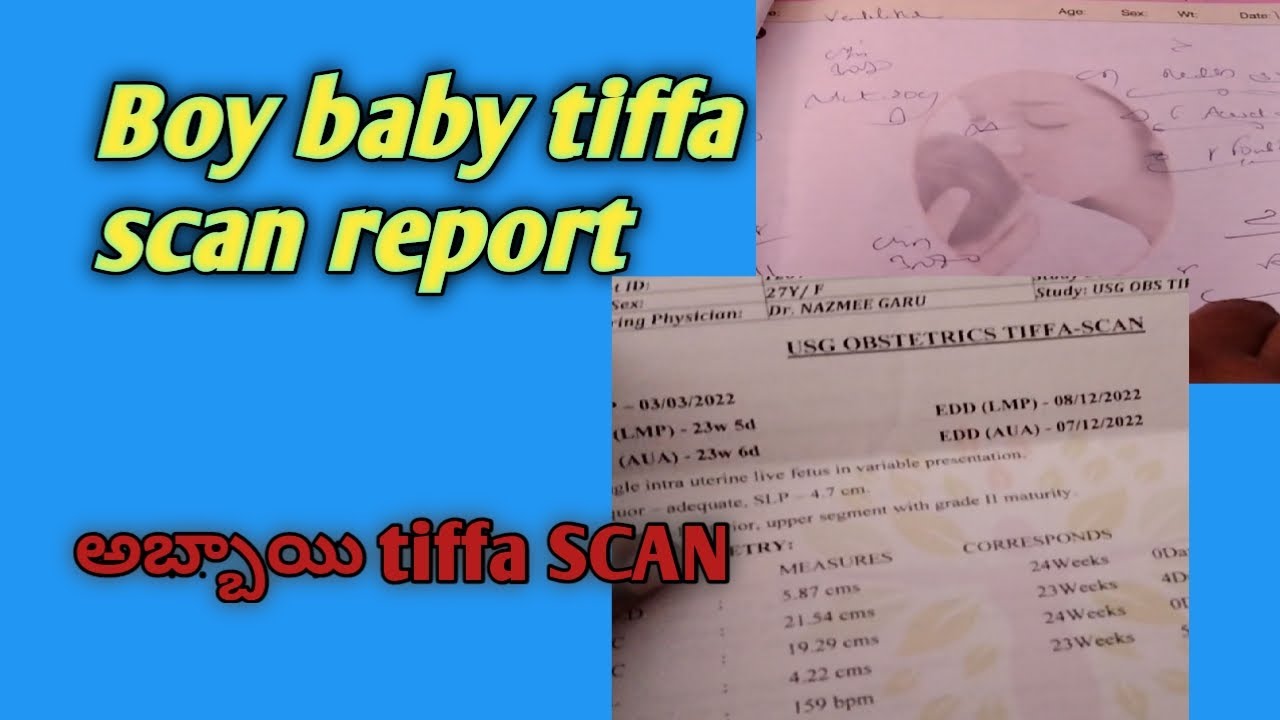 Boy Baby Tiffa Scan Report Baby Boy Scan Reports YouTube boy-baby-tiffa-scan-report-baby-boy-scan-reports-youtube