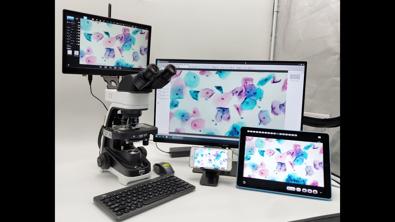 KoPa All-in-one smart camera TC1200 for Nikon Ei - YouTube