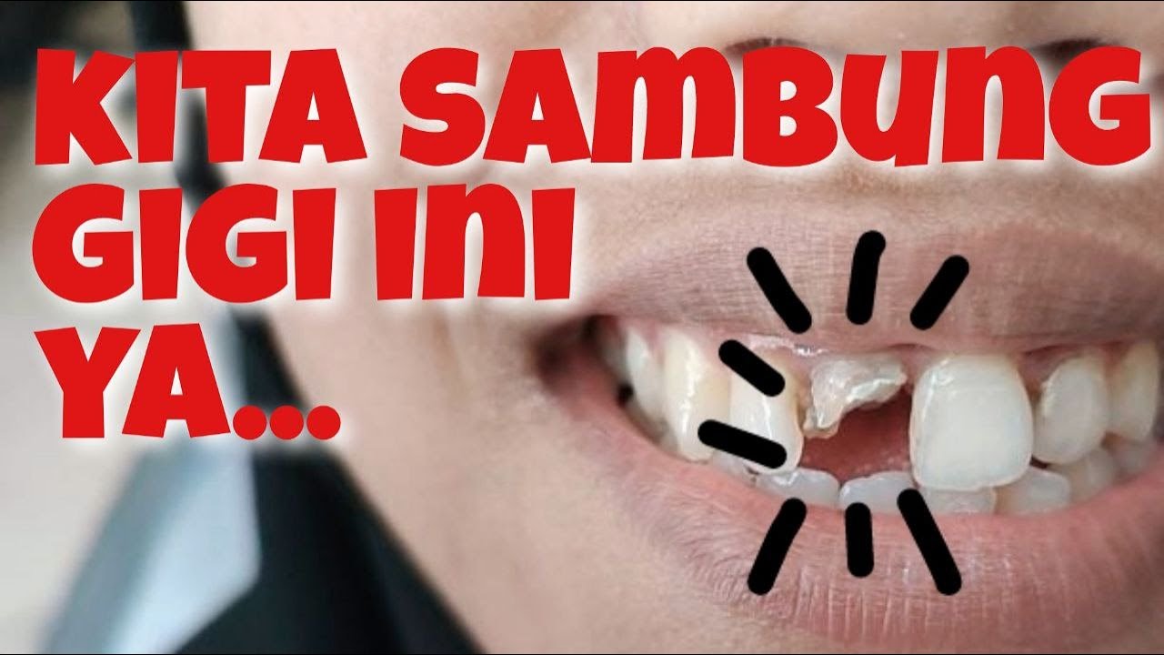 Wow… PERBAIKAN GIGI RUSAK !!! BROKEN TOOTH RESTORATION !!! - YouTube