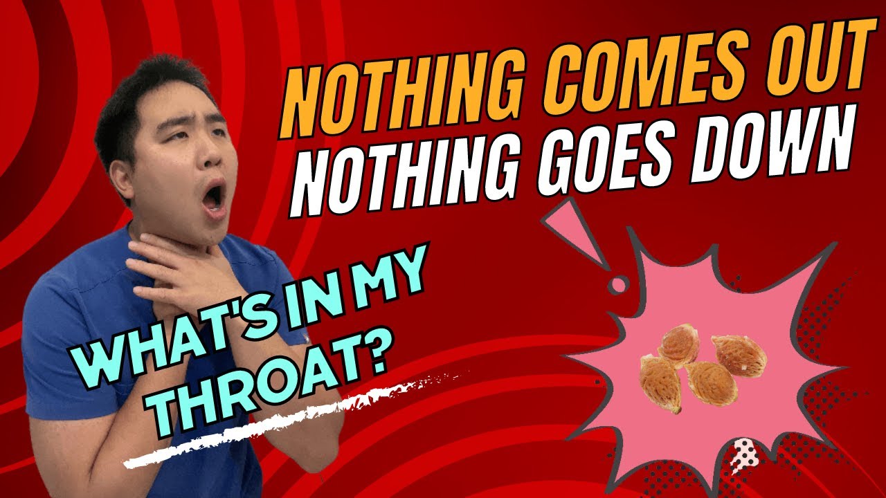 How to Treat Globus Pharyngeus: Insights from Conventional & Eastern ...