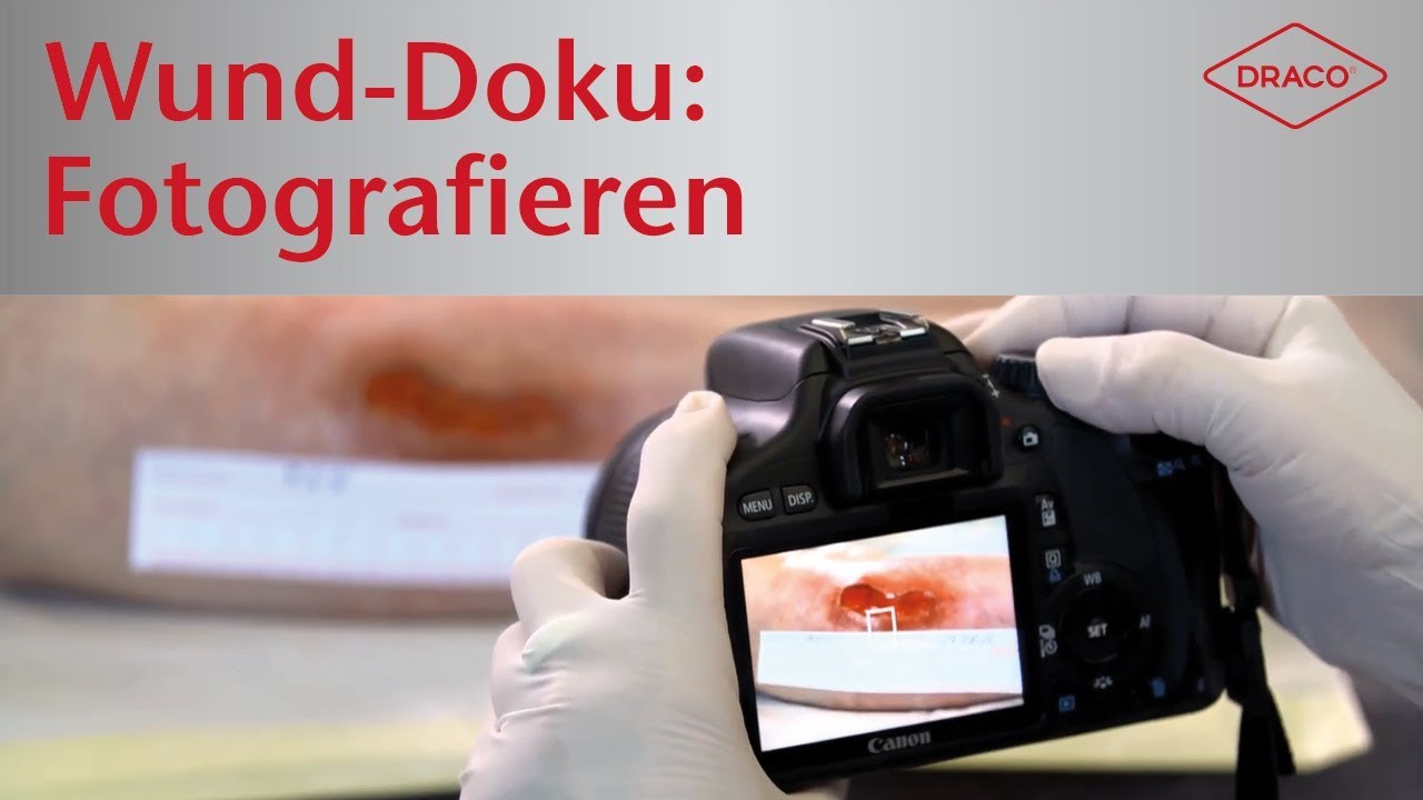 Wunddokumentation: Fotografieren der Wunde | DRACO - YouTube
