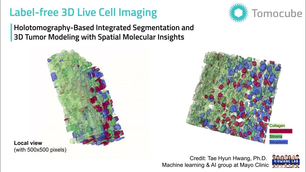 Holotomography-based integrated segmentation and 3D tumor modeling ...
