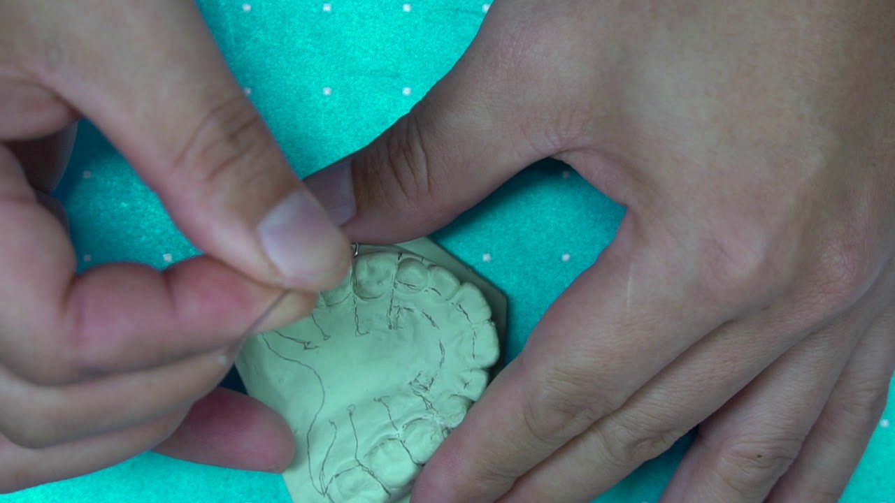 การดัด Triangular clasp - YouTube