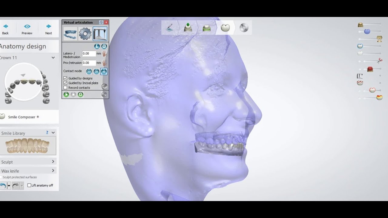 3d face scans for dental cad systems - YouTube