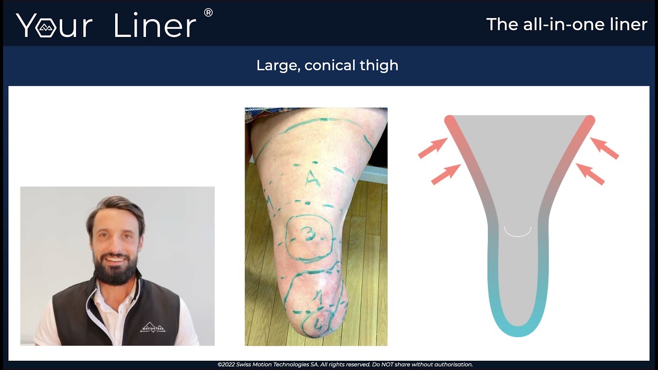 Fitting a Conical Thigh with Your® Liner - YouTube