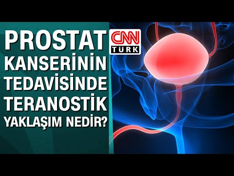 Prostat kanserinin tedavisinde teranostik yaklaşım nedir?