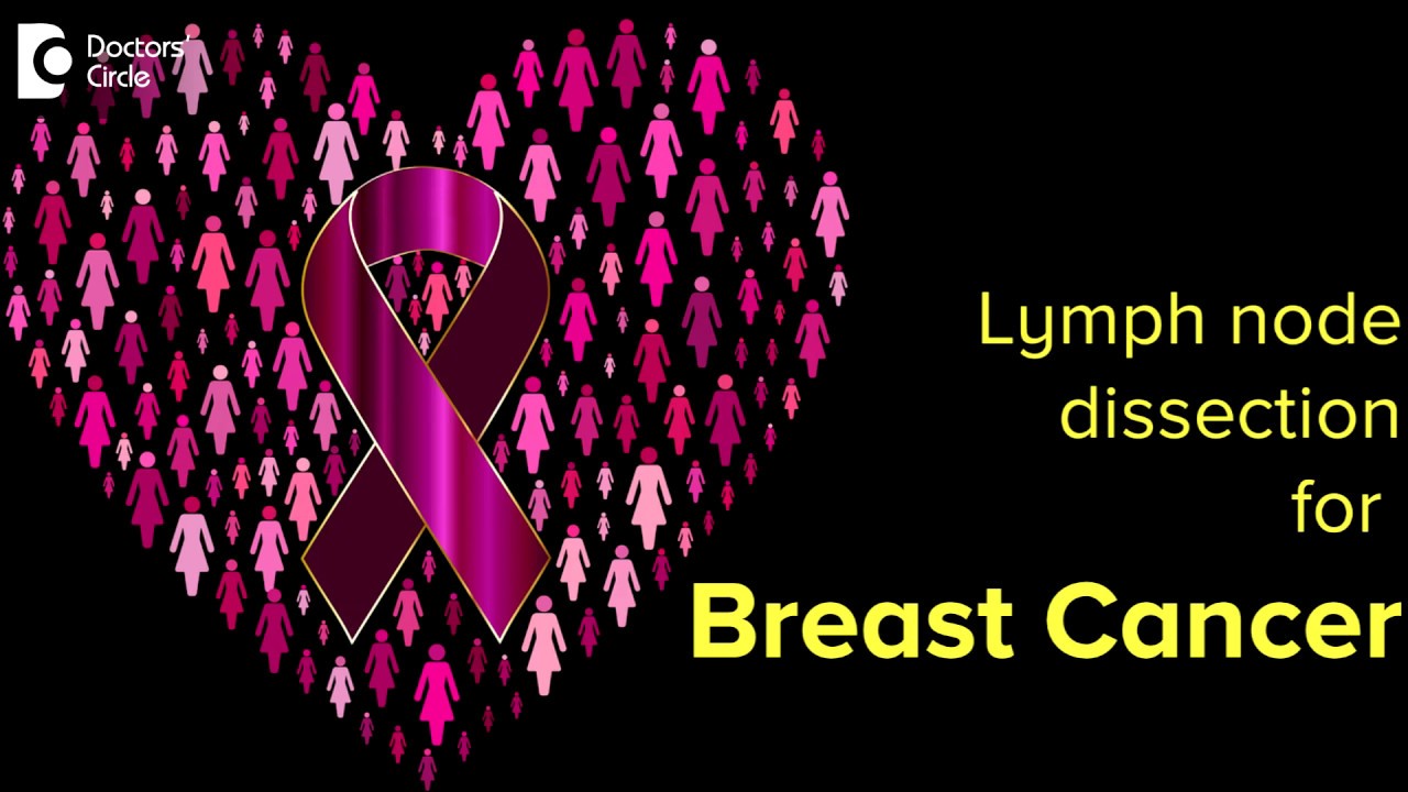 When is Lymph node dissection required for Breast Cancer? - Dr. Nanda ...