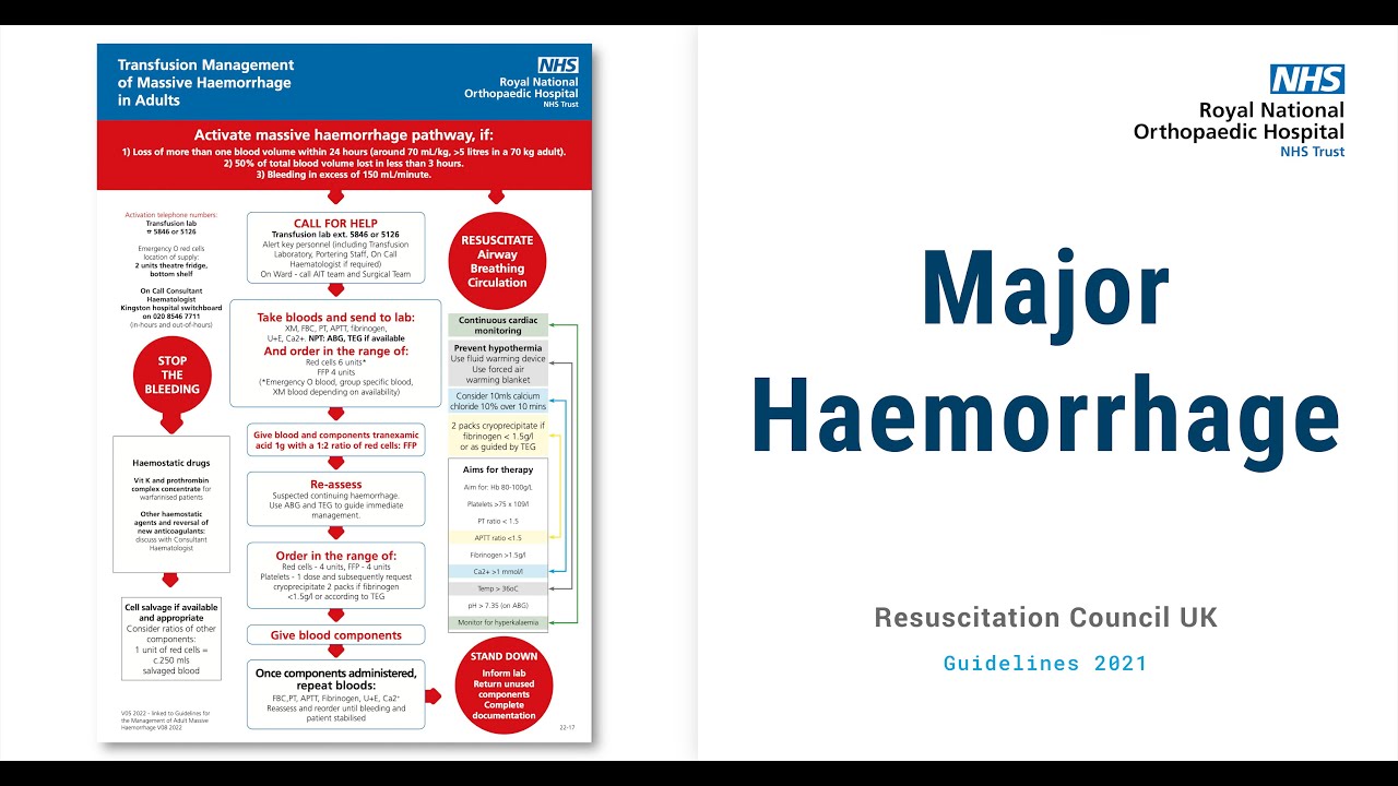 Major Haemorrhage SBAR handover - YouTube
