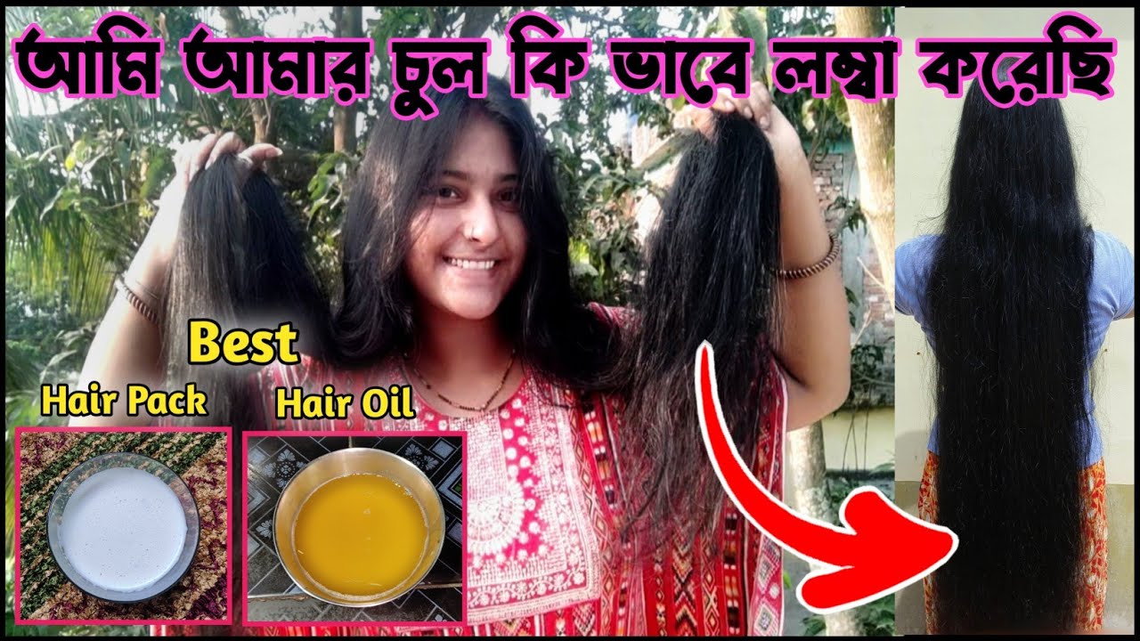 চুল লম্বা করার সহজ উপায় ॥ Fast Hair Growth Remedies ॥ Hair Growth Tips ...