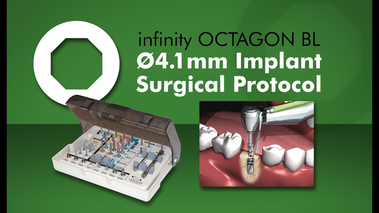infinity OCTAGON BL 4.1mm RP Implant Surgical Protocol - YouTube
