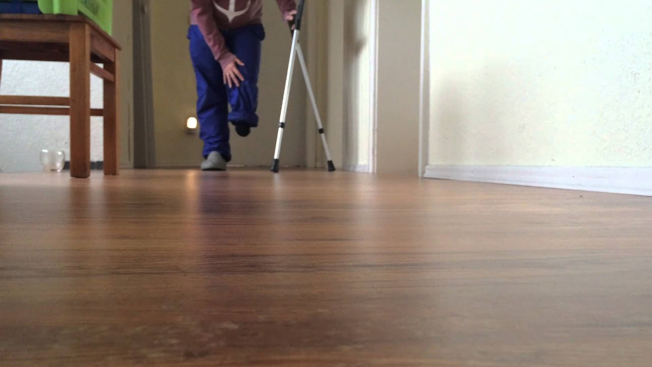 Crippled Foot amputeed - YouTube