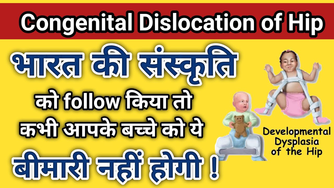Congenital Dislocation of Hip | CDH | Developmental dysplasia of Hip ...