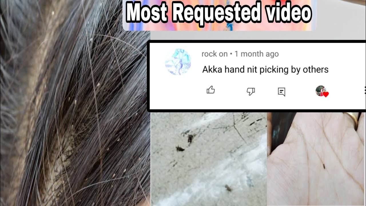 Hand Nit Picking By Others//Most Requested video//@beautychef1356 ... - YouTube
