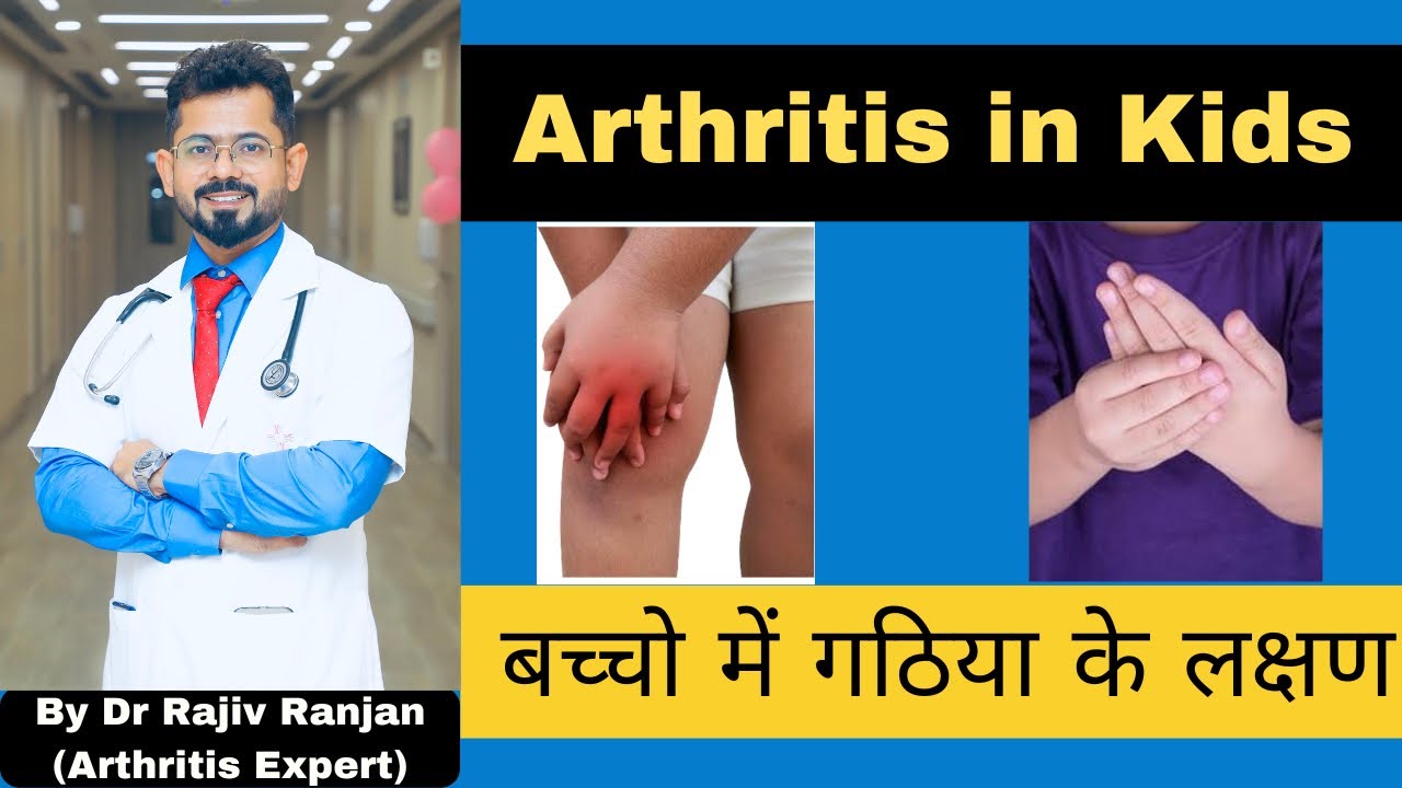 क्या बच्चो में गठिया हो सकता है ? | Juvenile Arthritis | Arthritis in ...