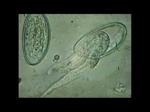 Enterobius vermicularis (kıl kurdu) Yumurtası
