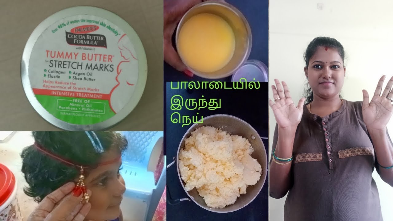 Winter Skin Care For A Tummy In Pregnancy Time Stretch Mark Remove Ghee winter-skin-care-for-a-tummy-in-pregnancy-time-stretch-mark-remove-ghee