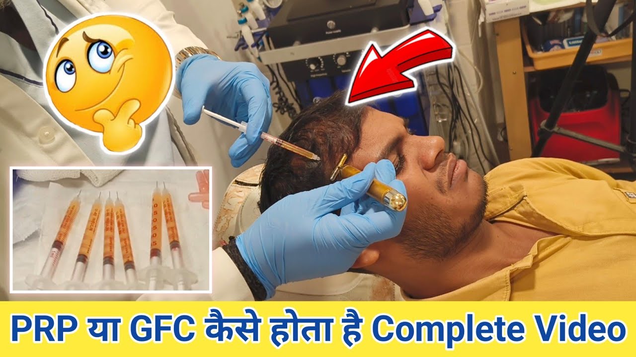 PRP Hair Loss Treatment Before And After Results GFC Hair Treatment ...