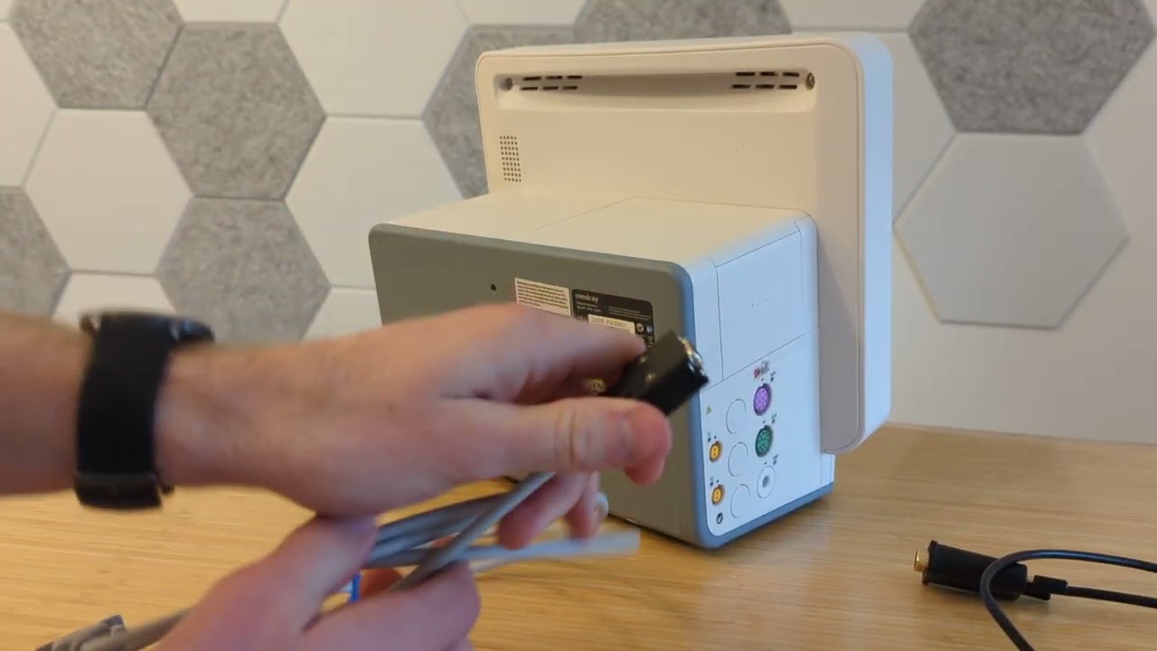 Mindray ePM 12 / ePM 10 Integration - YouTube