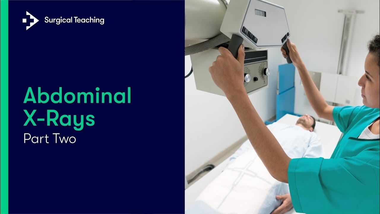 Abdominal X-Rays Part 2: | How to Analyse X-Rays and Identify ...