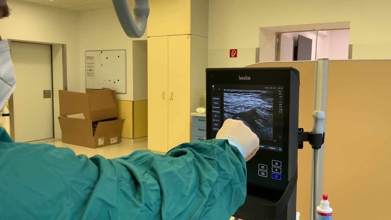 ZVK Anlage Vena subclavia links Ultraschall gesteuert inplane - YouTube