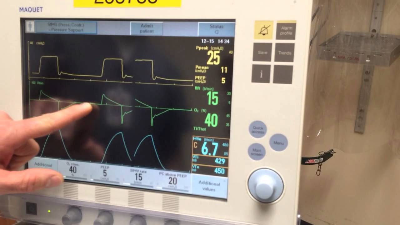 How to set inspiratory time without an order - YouTube