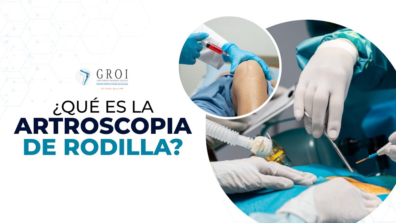 ¿Qué es la artroscopia de rodilla? - YouTube