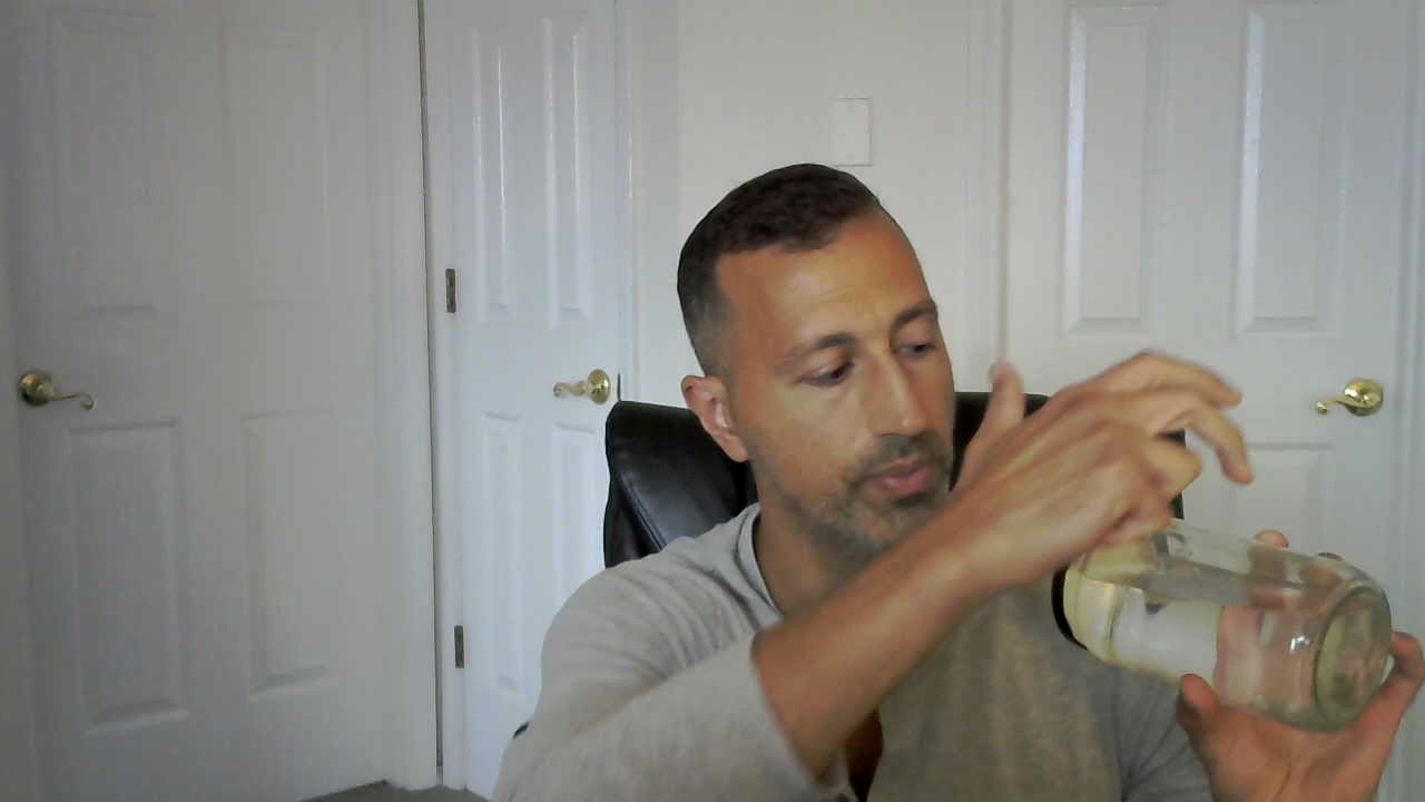 Mechanism of Shifting Dullness - YouTube