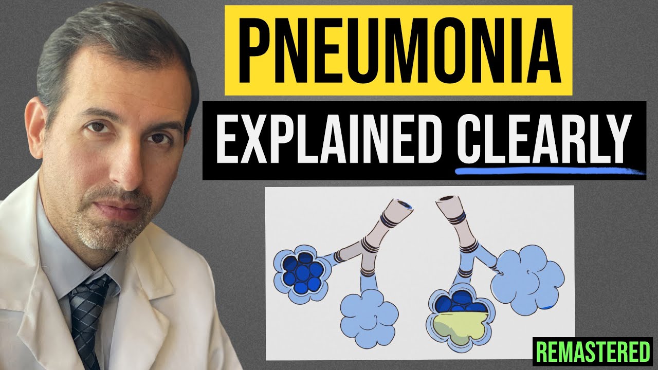 Pneumonia Explained! Symptoms, Diagnosis, Labs, Treatment - YouTube