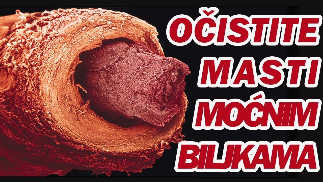 SAVRŠENA HRANA ZA OBNOVU TIJELA I ČIŠĆENJE CRIJEVA I JETRE! Dr ...