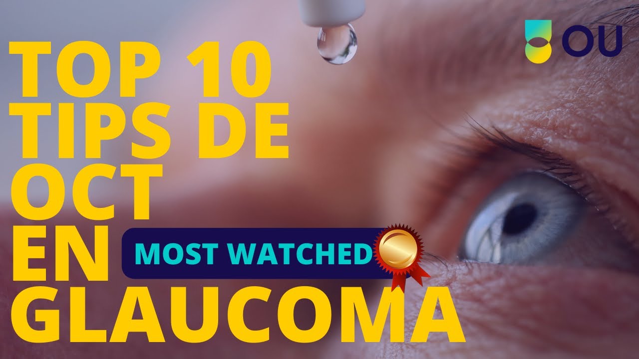 Top 10 Tips de OCT en Glaucoma - YouTube