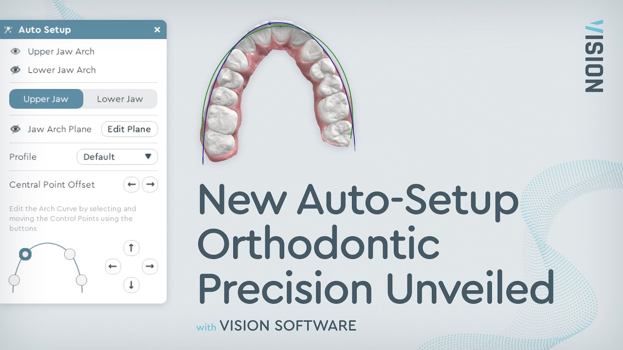 Auto Setup in VISION | Setup for Orthodontic Treatment - YouTube