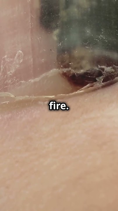 This Man Was Struck by Lightning… 7 TIMES?! ⚡😱 #Shorts - YouTube